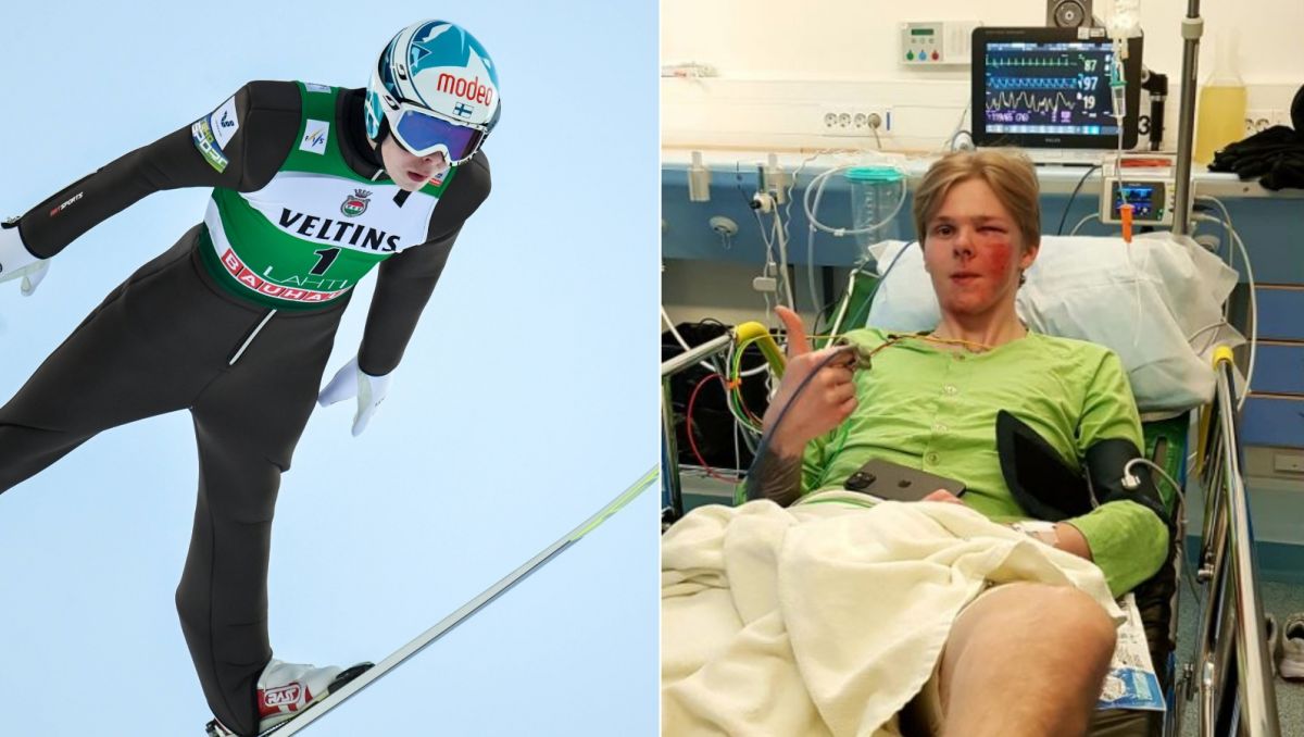 Syn legendy skoków zakończył sezon groźnym upadkiem | TVP SPORT